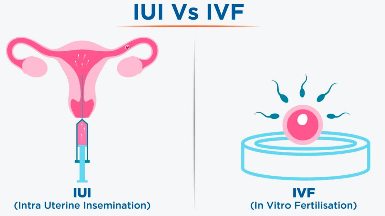 IVF vs. IUI: What’s the Difference and Which Is Right for You? - Orange ...